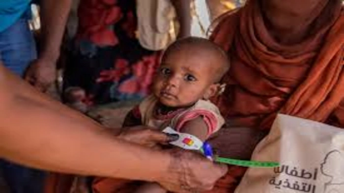 A consensus-driven evaluation of acute malnutrition, severe food ...